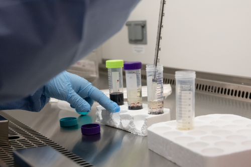 Vitalant Launches National Service Hubs to Expand Patient Access to Cell and Gene Therapies